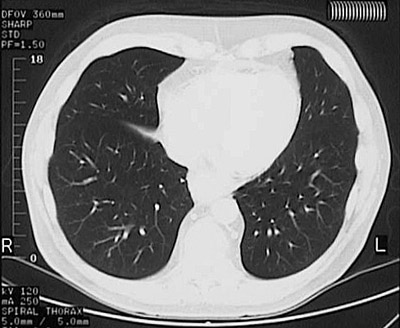 Pulmonary Radiologic Images