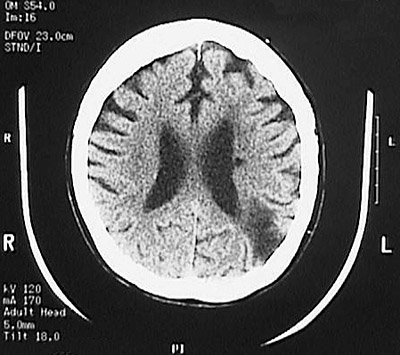 CNS Radiologic Images